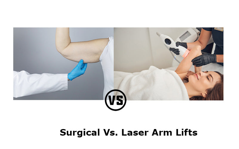 Surgical Arm Lift Vs. Laser Arm Lift - Which Is Best?